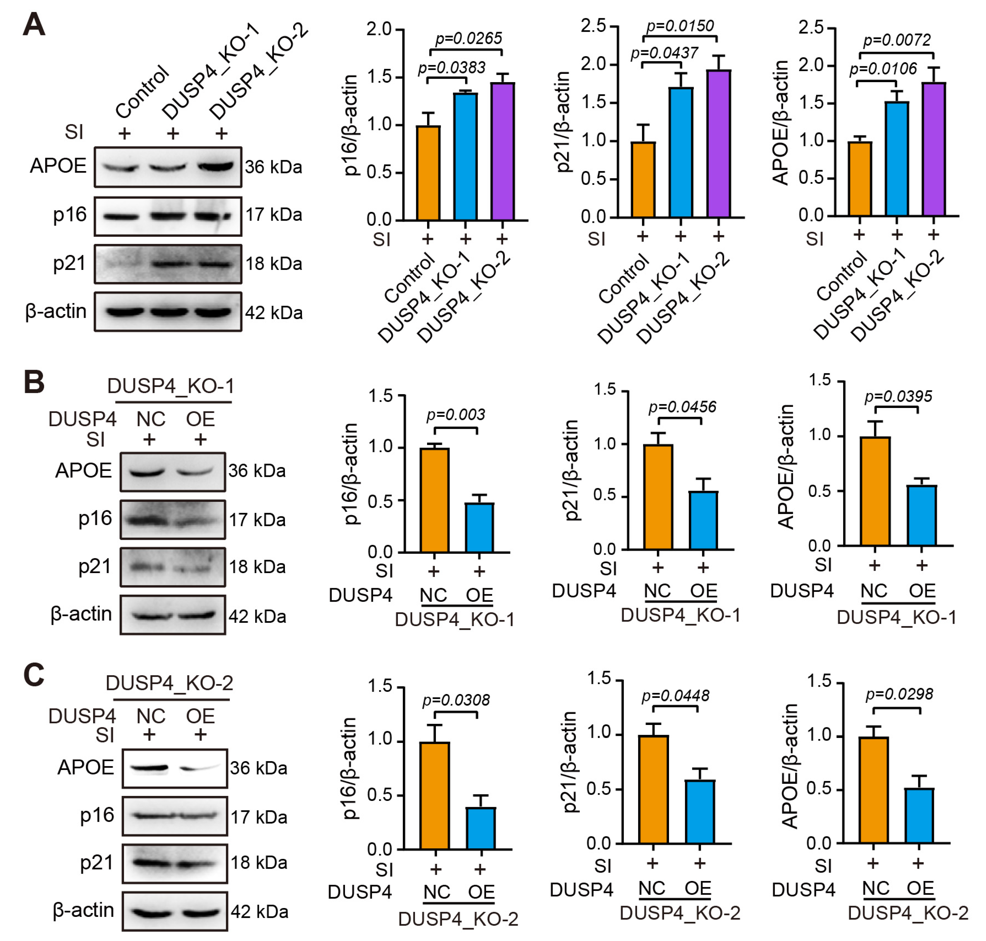 The Protective Role of DUSP4 in Retinal Pigment Epithelium Senescence ...