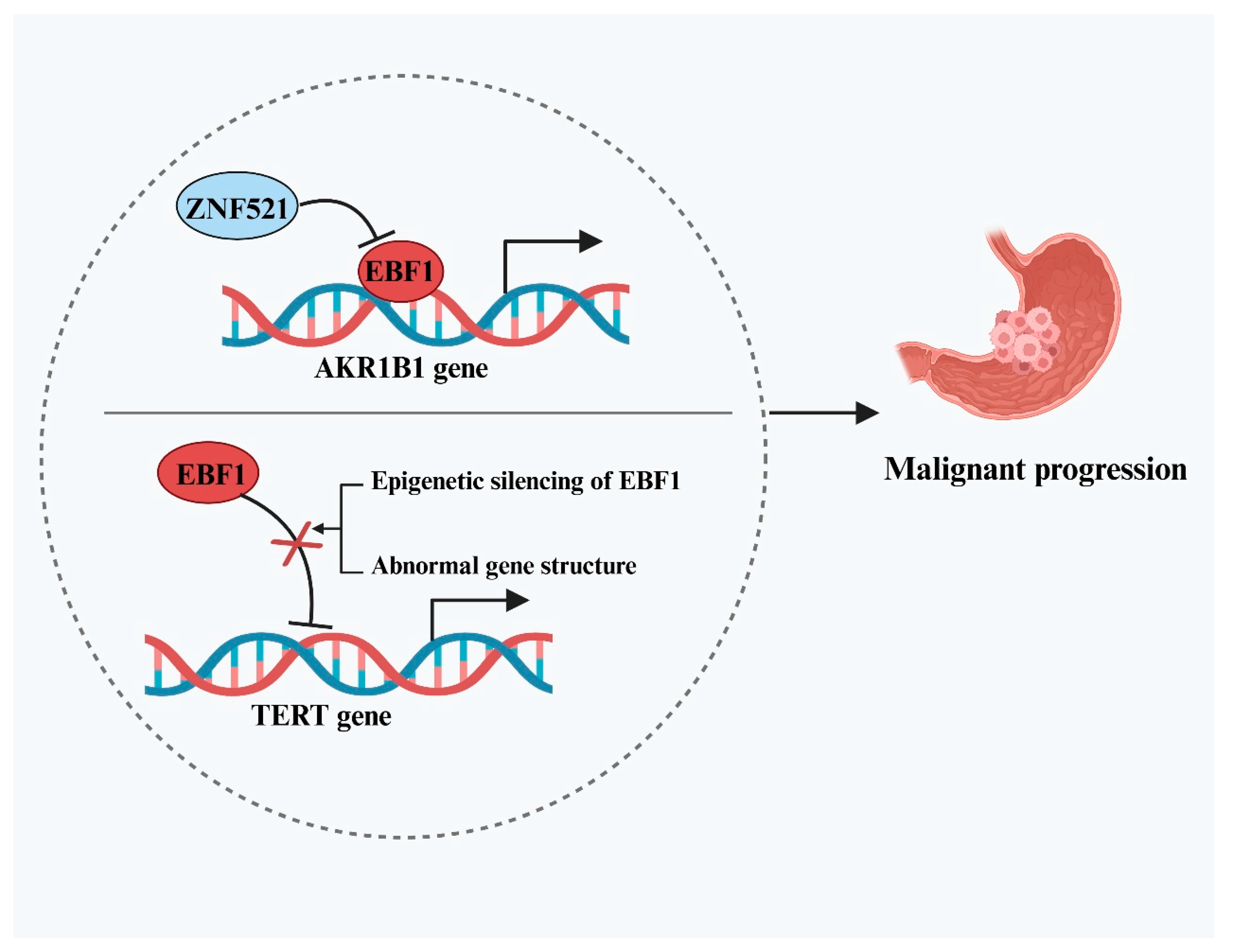 Advances in Research on the B-Lineage Transcription Factor EBF1 in ...