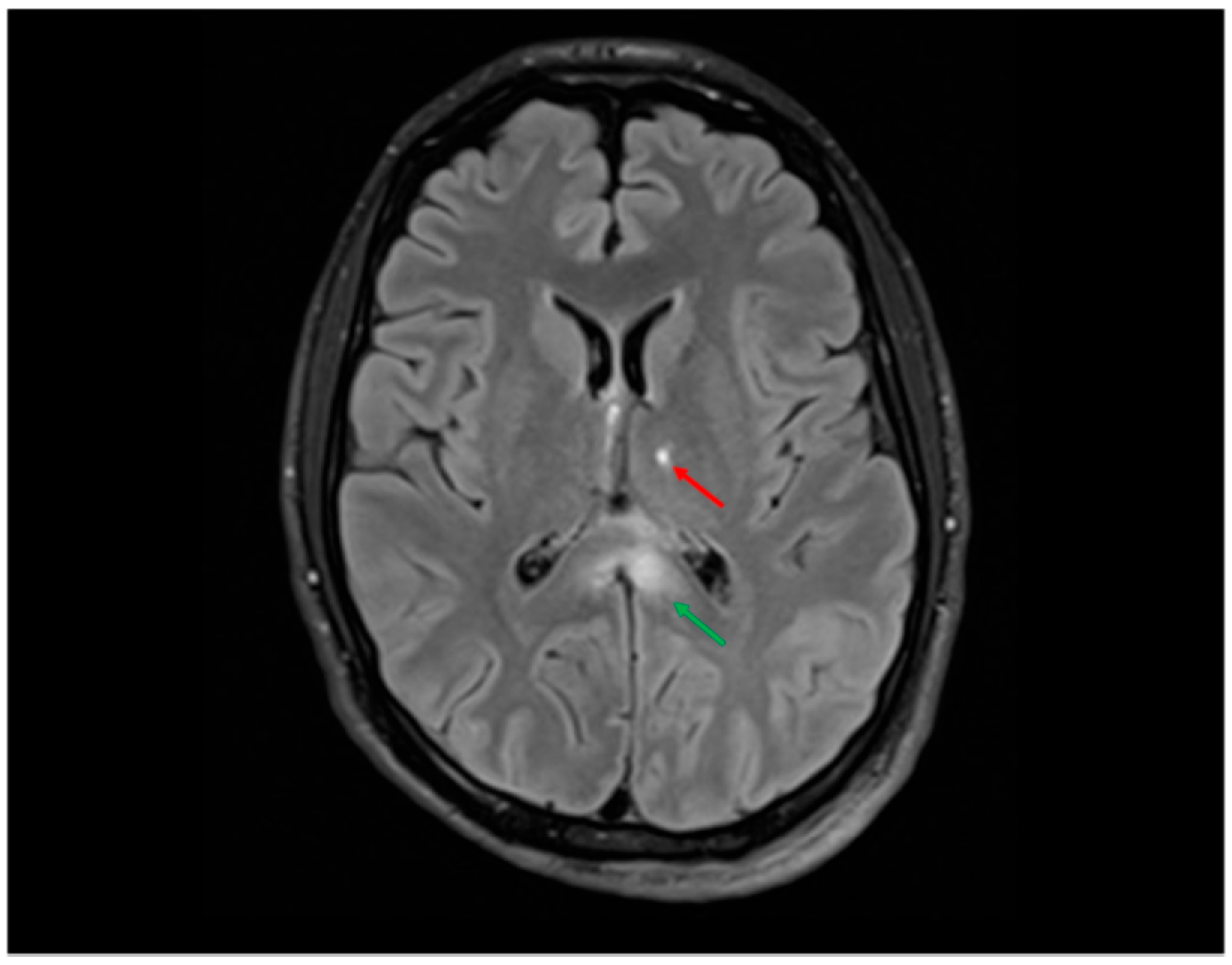 Integrative Diagnostic and Prognostic Paradigms in Diffuse Axonal ...