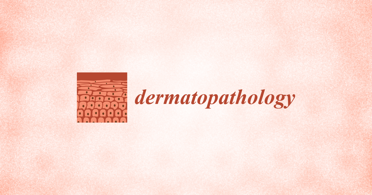 Acral Melanocytic Neoplasms: A Comprehensive Review of Acral Nevus and ...