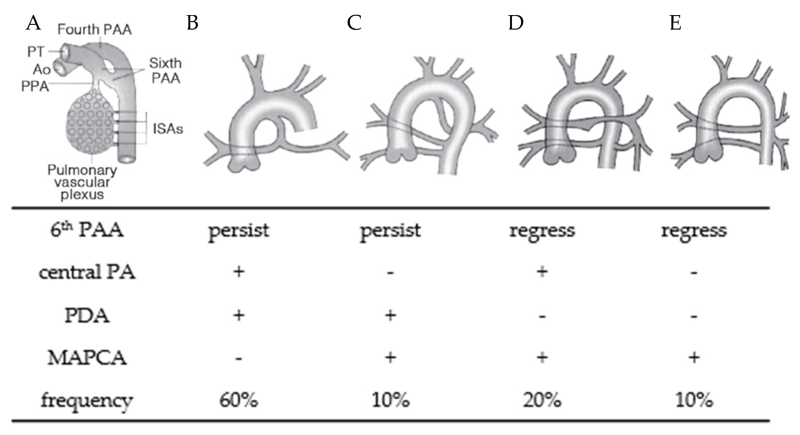 Unique Pulmonary Hypertensive Vascular Diseases Associated with Heart ...