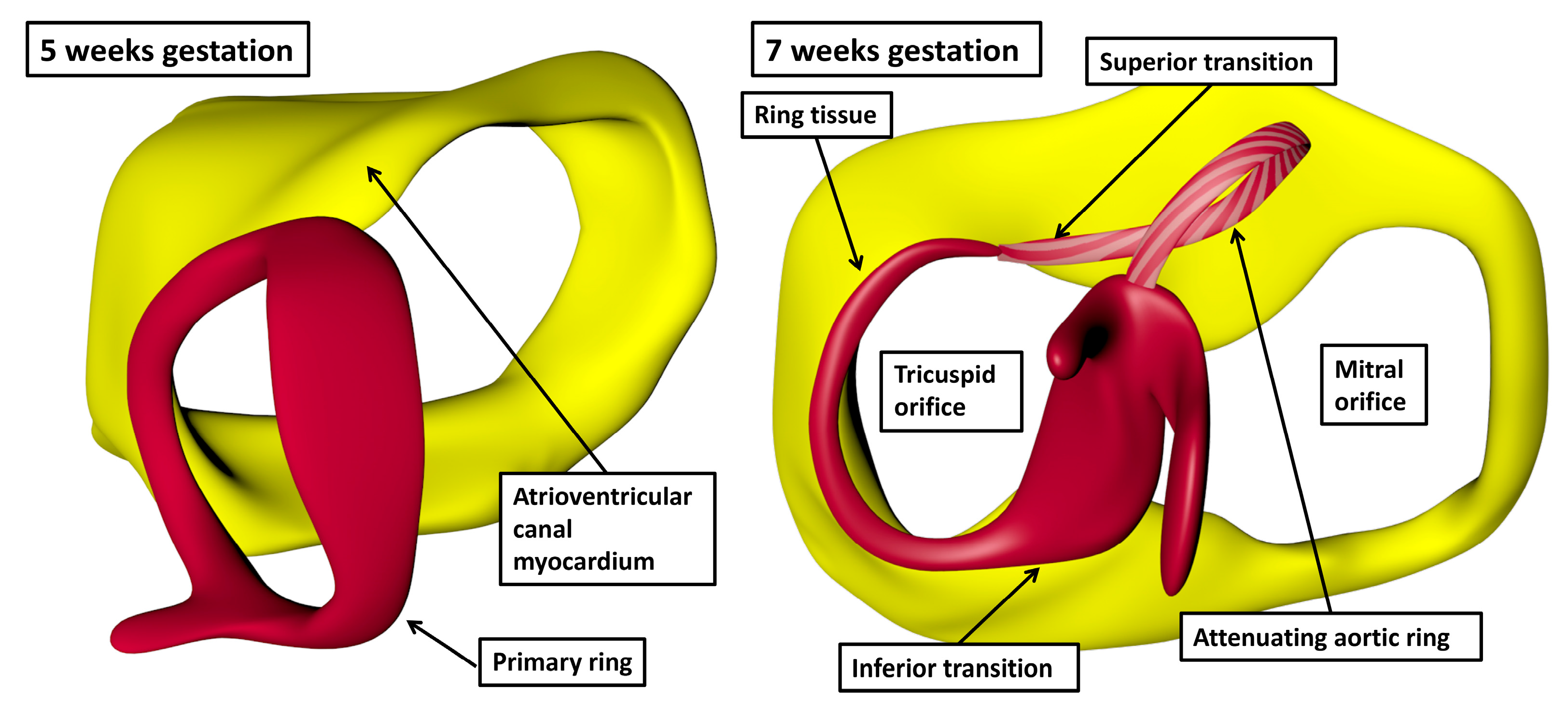 The Anatomy of the Atrioventricular Node | MDPI
