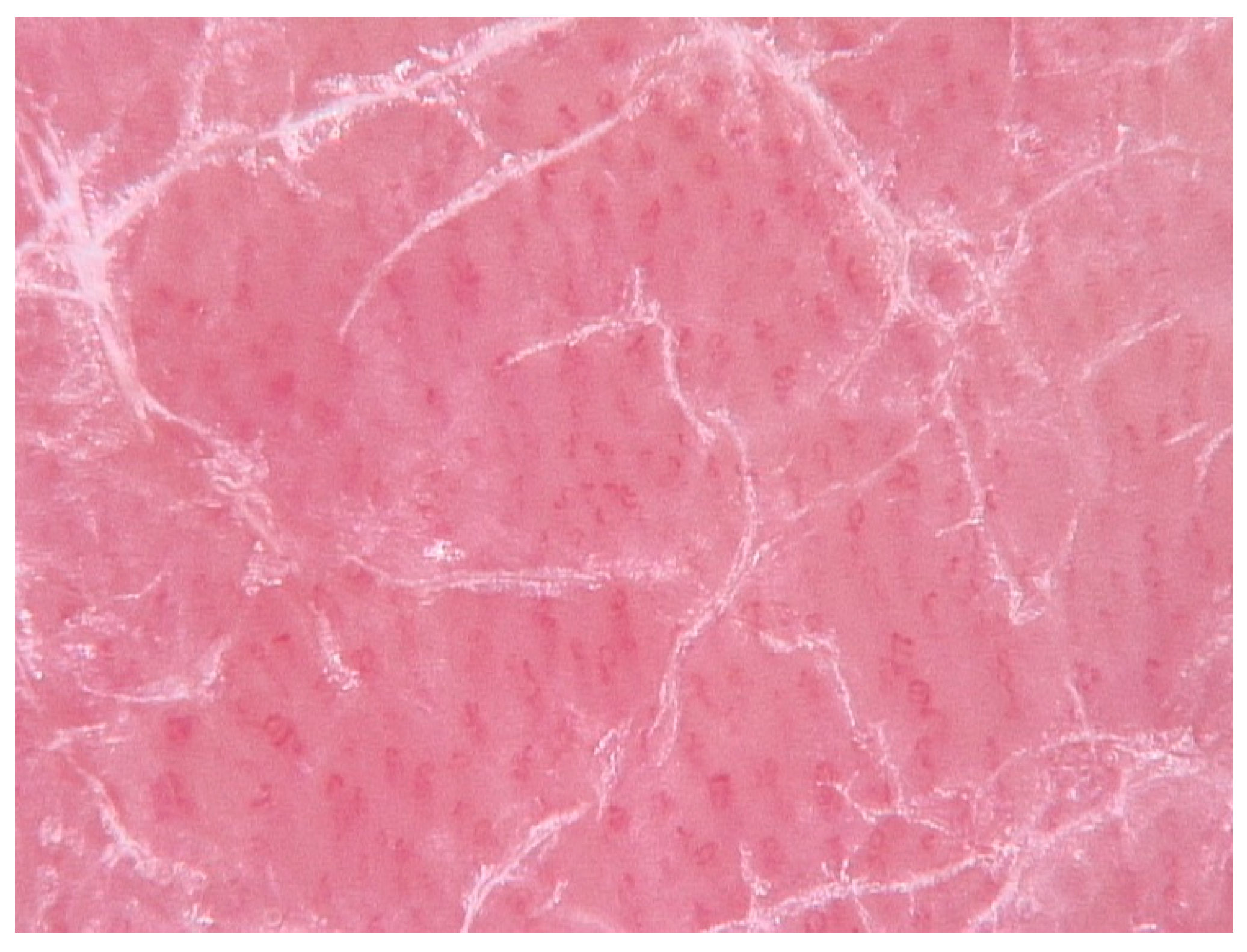 Topographic Differential Diagnosis of Chronic Plaque Psoriasis ...