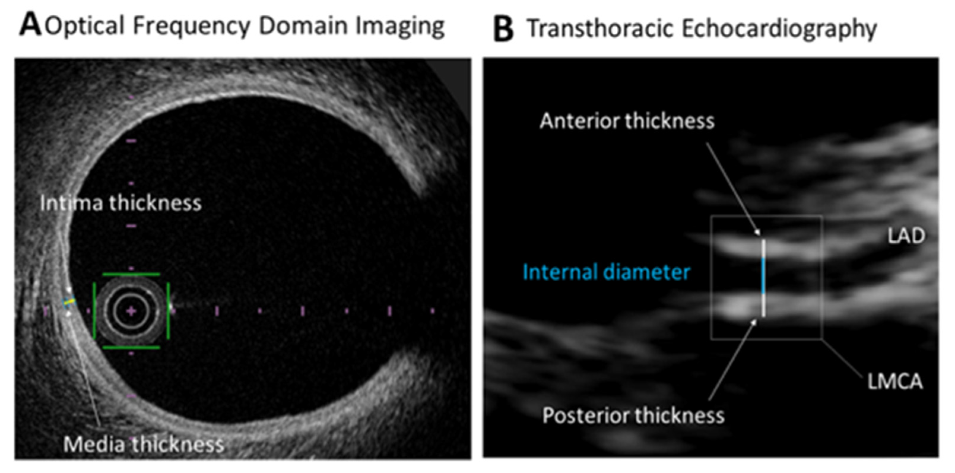 Evaluation of Transthoracic Echocardiography in the Assessment of ...