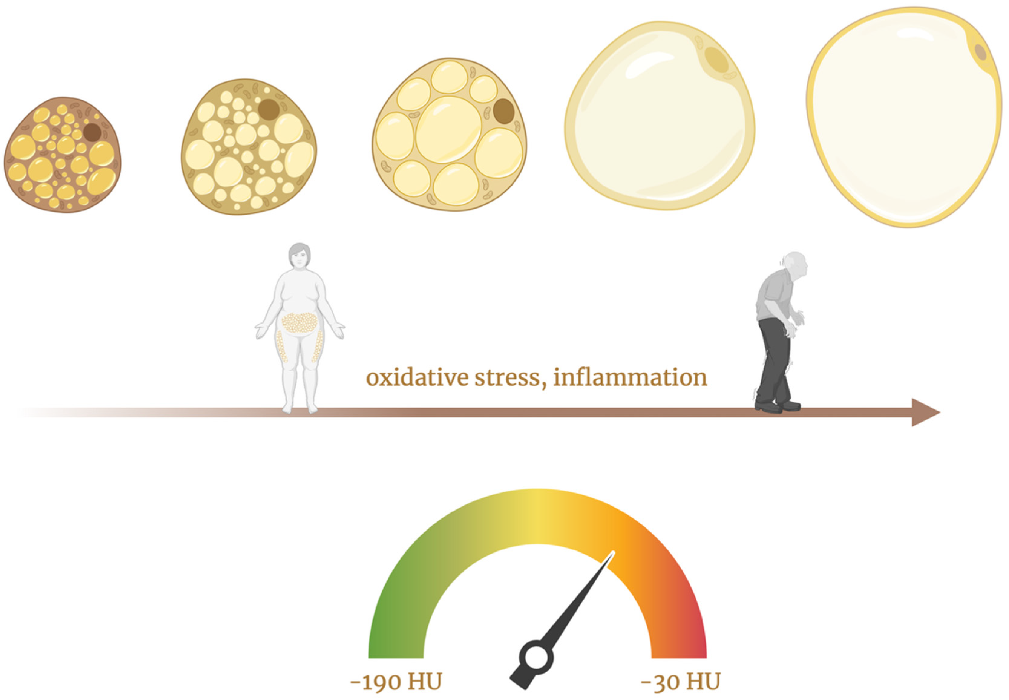 The Perivascular Fat Attenuation Index: Bridging Inflammation and ...