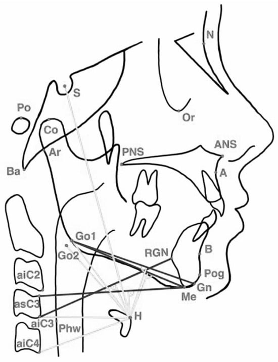 Effects of Web-Based Orofacial Myofunctional Therapy on Hyoid Bone ...
