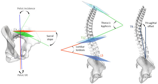 Spine Kinematics Behavior During the Handstand Posture: A Biplanar ...