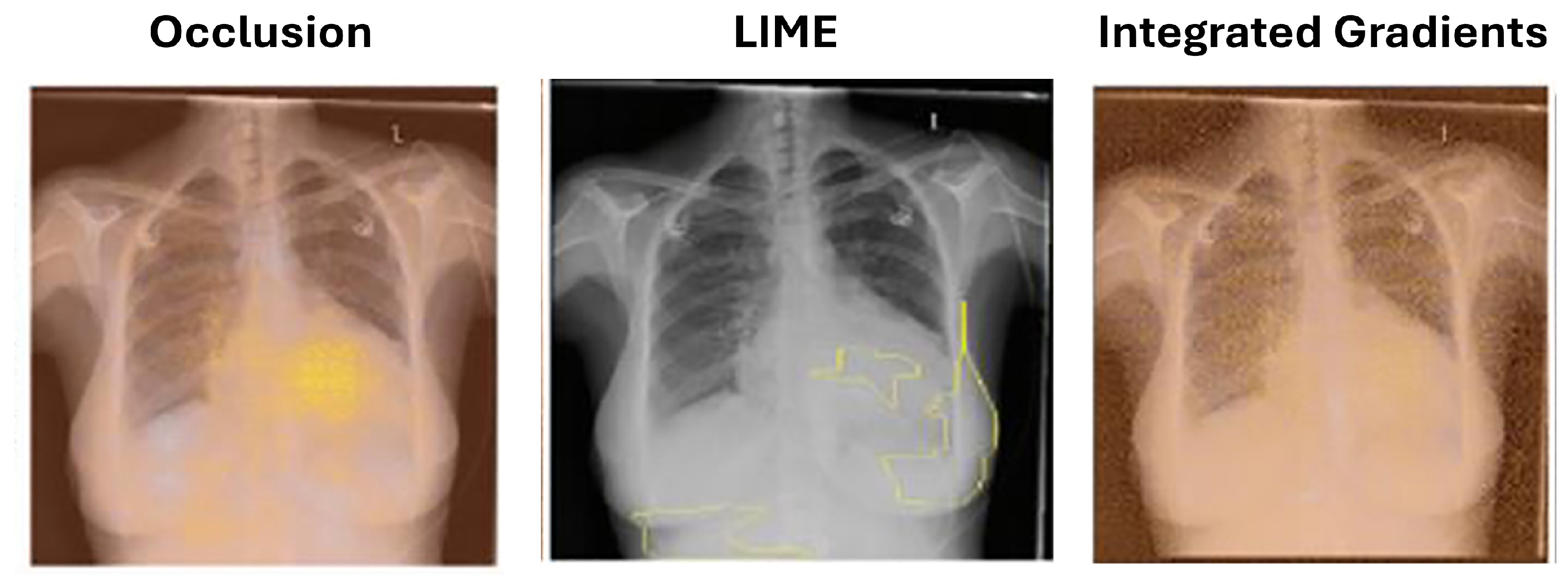 A Survey on Explainable Artificial Intelligence (XAI) Techniques for Visualizing Deep Learning ...