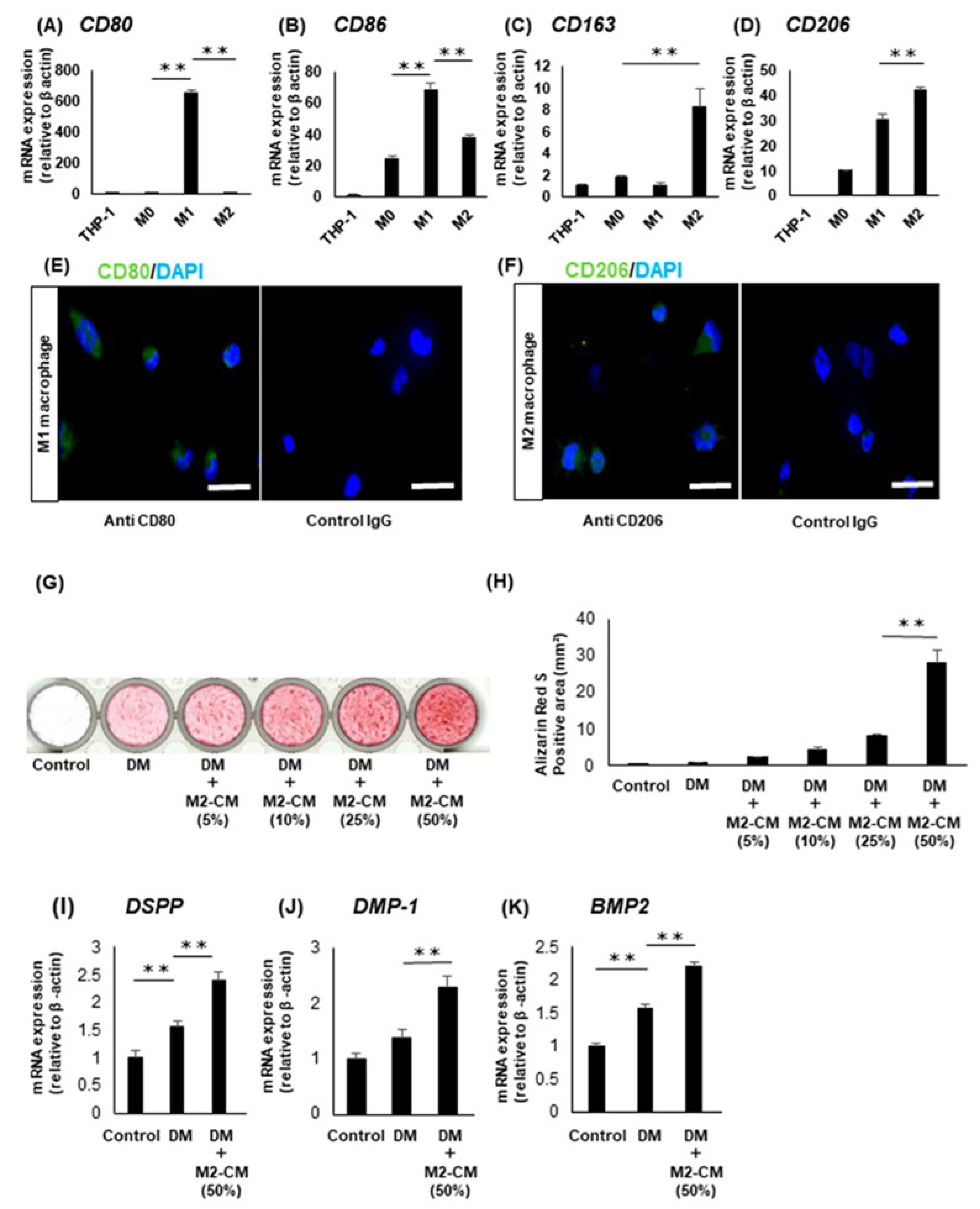 Involvement of M1/M2 Macrophage Polarization in Reparative Dentin ...