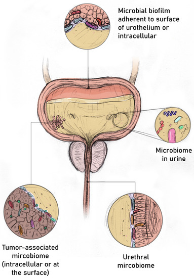 The Urinary Microbiome and Bladder Cancer | MDPI