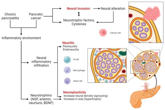 Neuropancreatology: The Nervous System and Pain Management in ...
