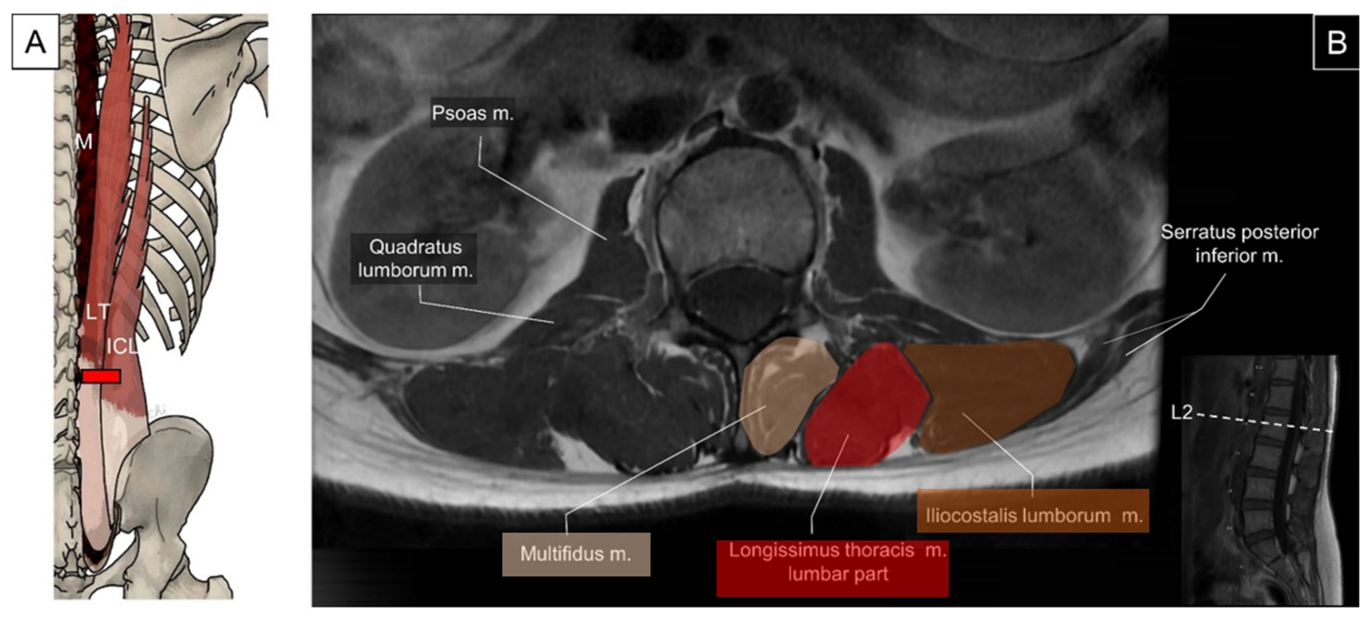 Pictorial Essay on Ultrasound and Magnetic Resonance Imaging of ...