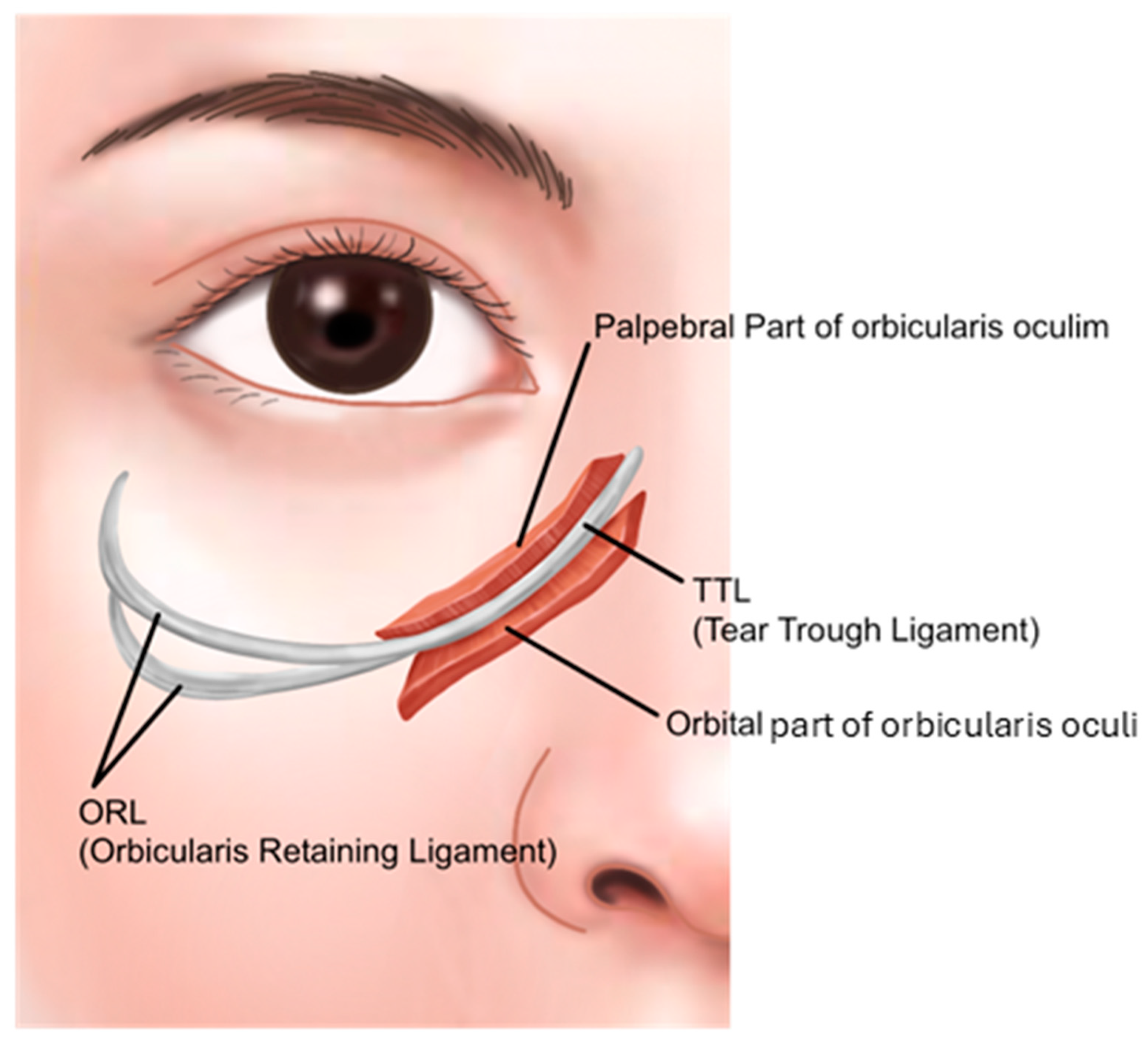 Anatomical-Based Filler Injection Diagnosis to Treatment Techniques ...
