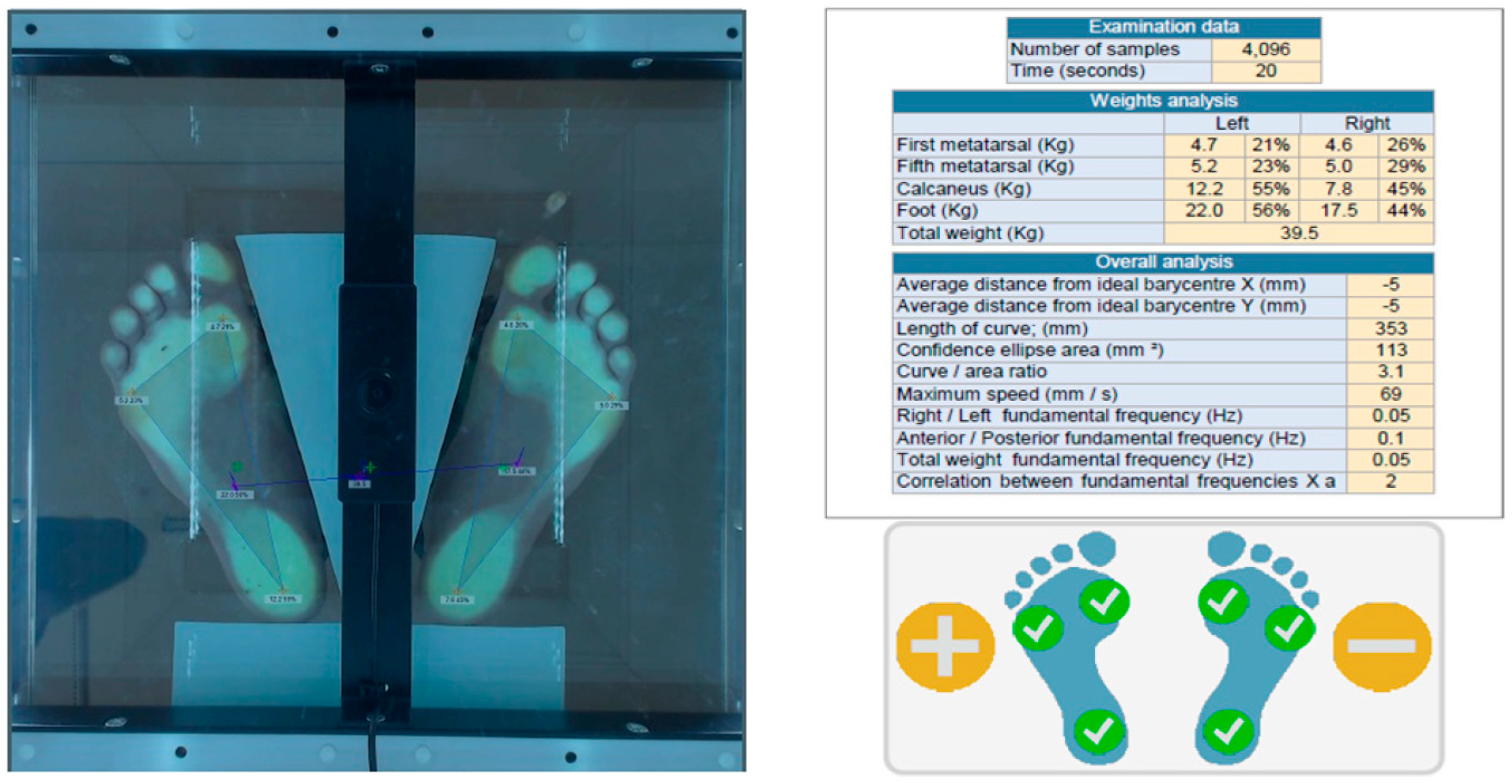 Myotonometric, Static Plantar Pressure, and Stabilometric Assessment in ...