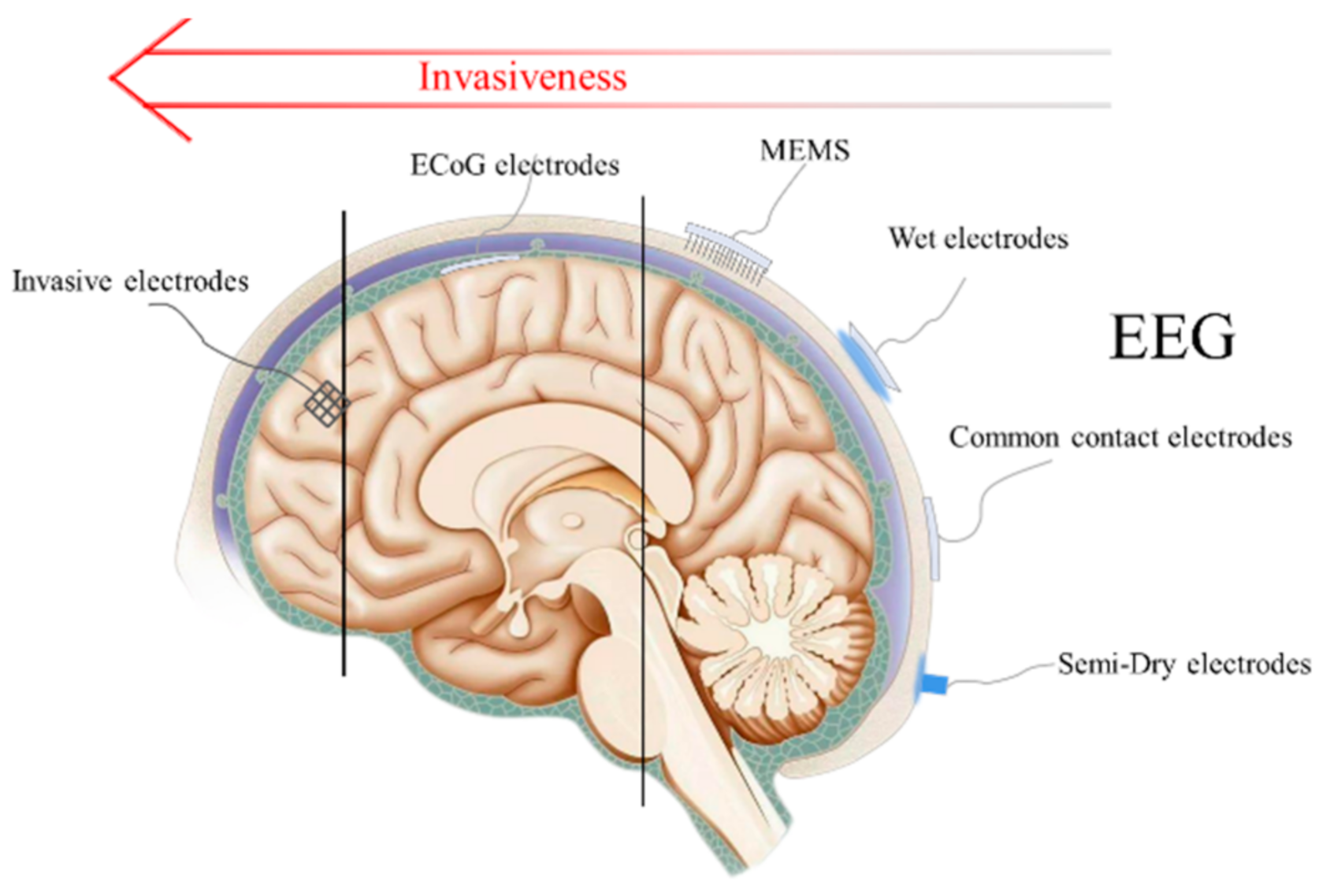 State of the Art of Non-Invasive Electrode Materials for Brain–Computer ...
