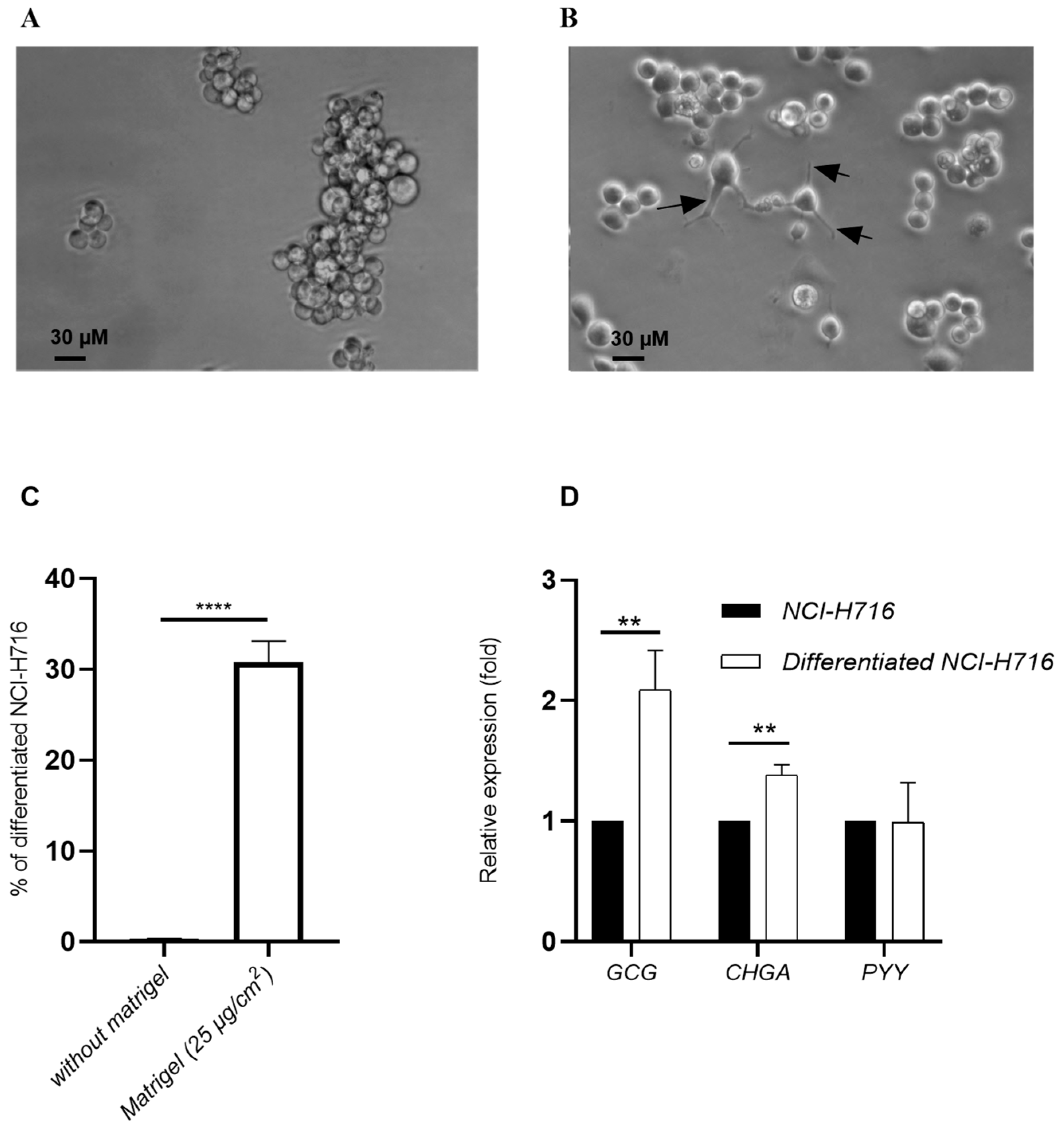 Roseburia intestinalis Modulates PYY Expression in a New a ...