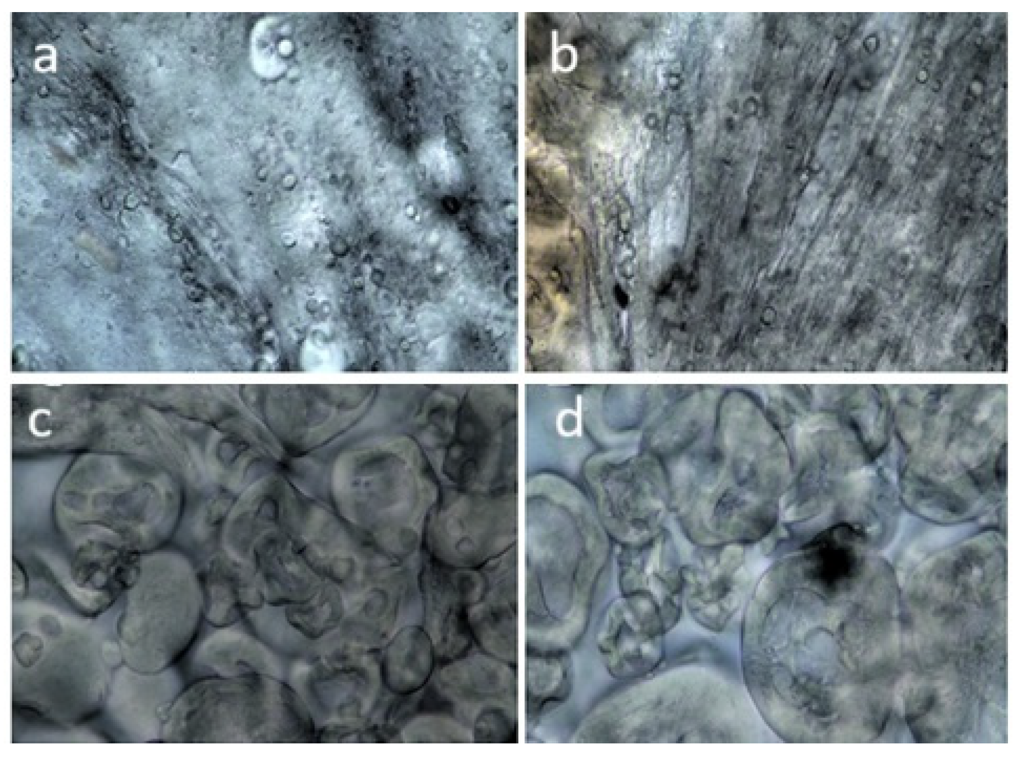 Gluten Functionality Modification: The Effect of Enzymes and Ultrasound ...