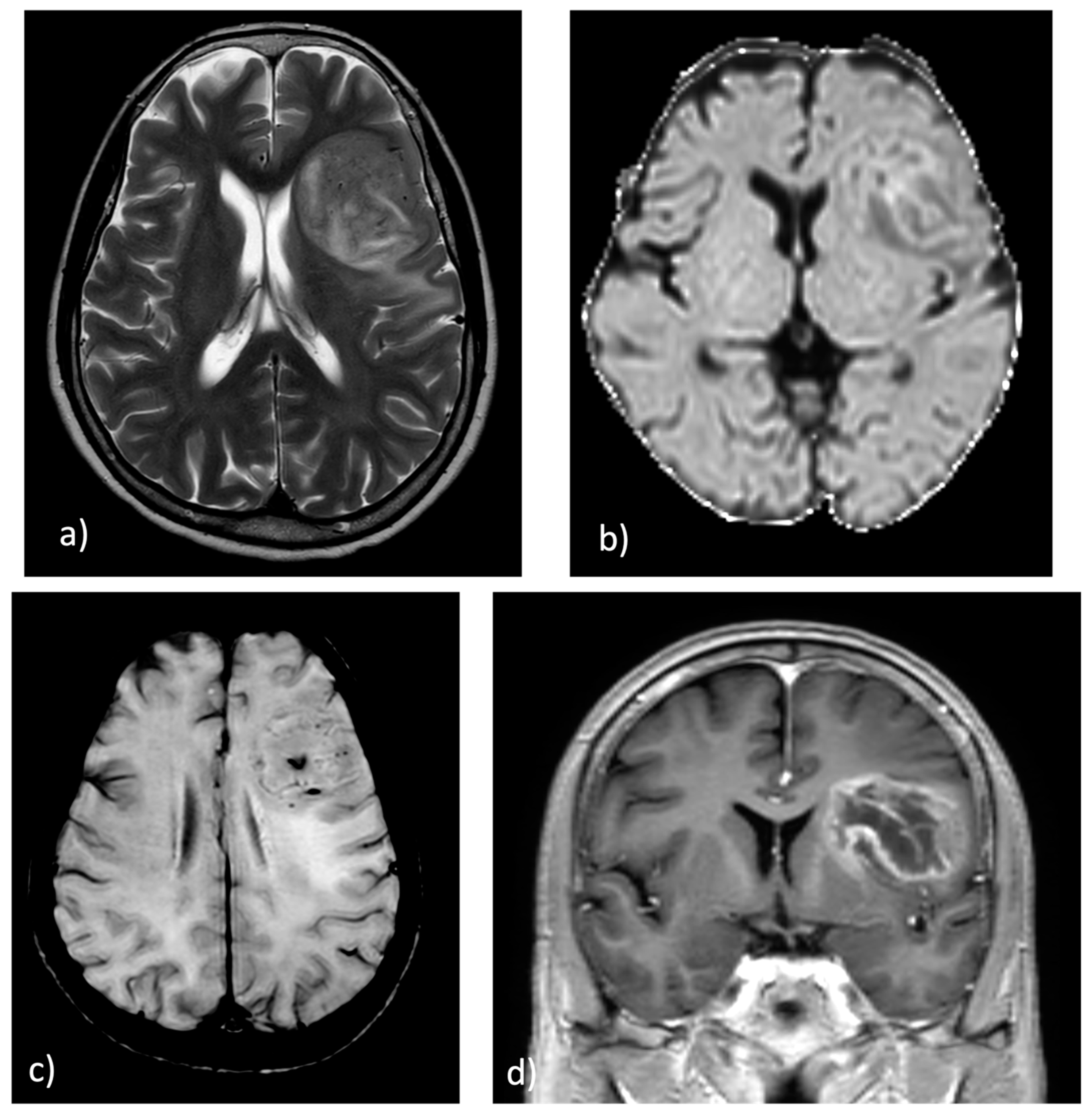 Imaging Recommendations for Diagnosis, Staging, and Management of ...
