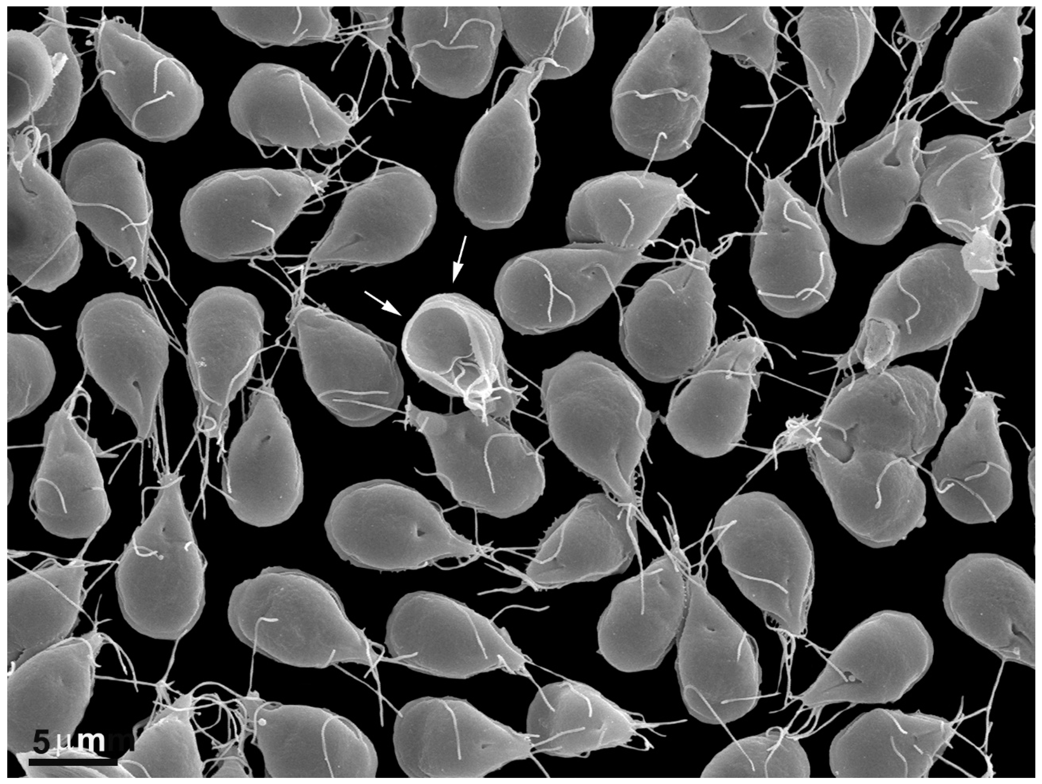 Ultrastructural Alterations of the Human Pathogen Giardia intestinalis ...