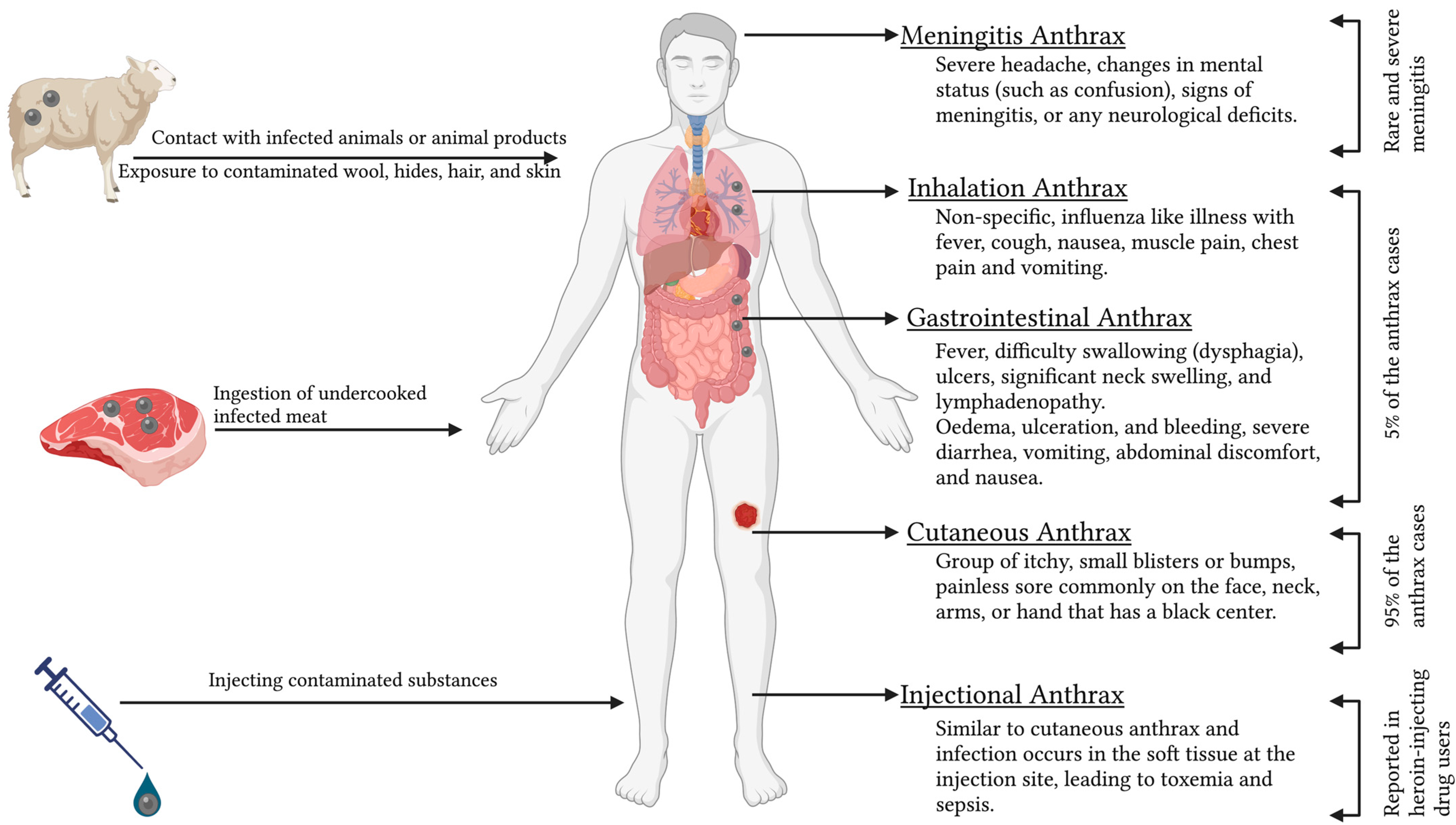 Anthrax in Humans, Animals, and the Environment and the One Health ...