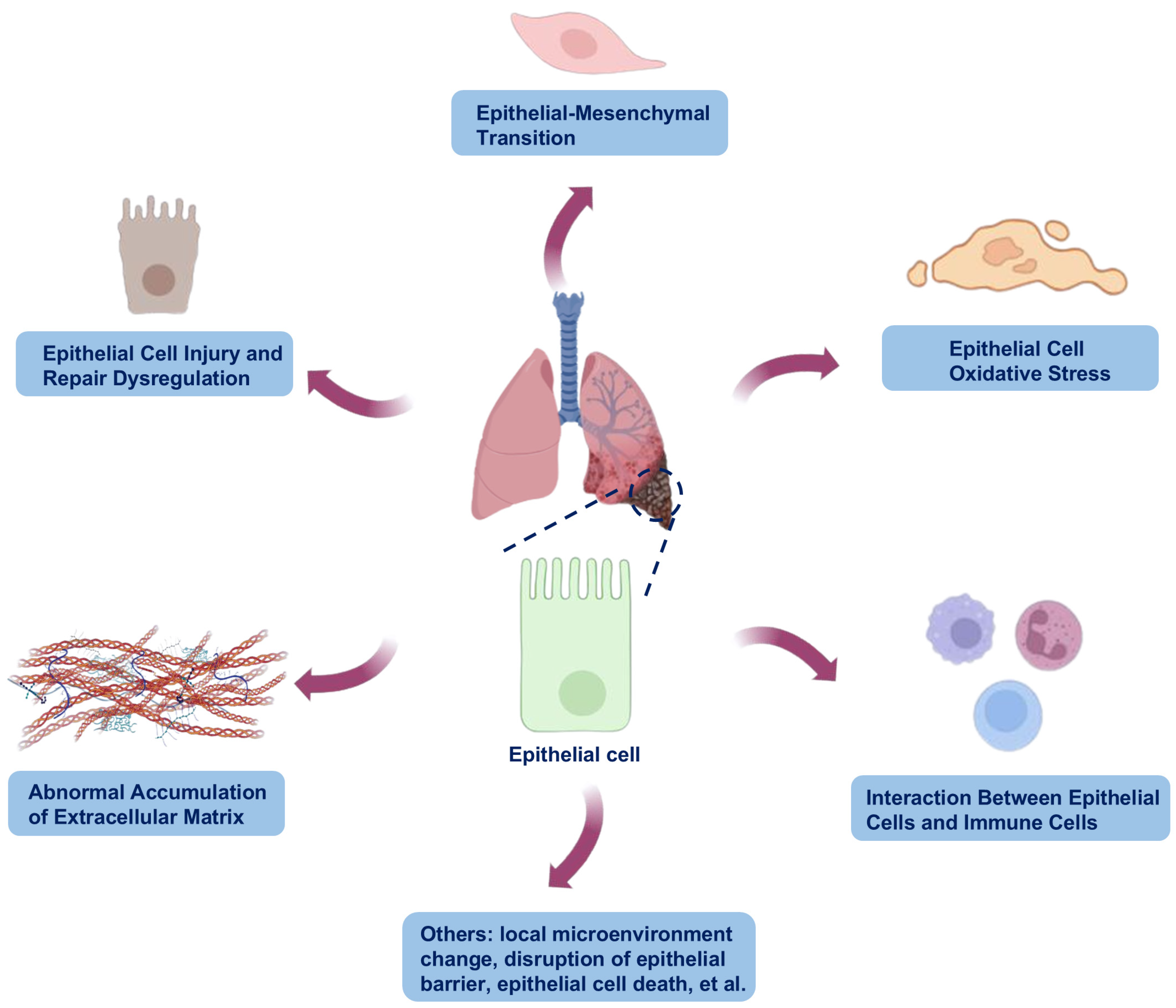 Epithelial Cell Dysfunction in Pulmonary Fibrosis: Mechanisms ...