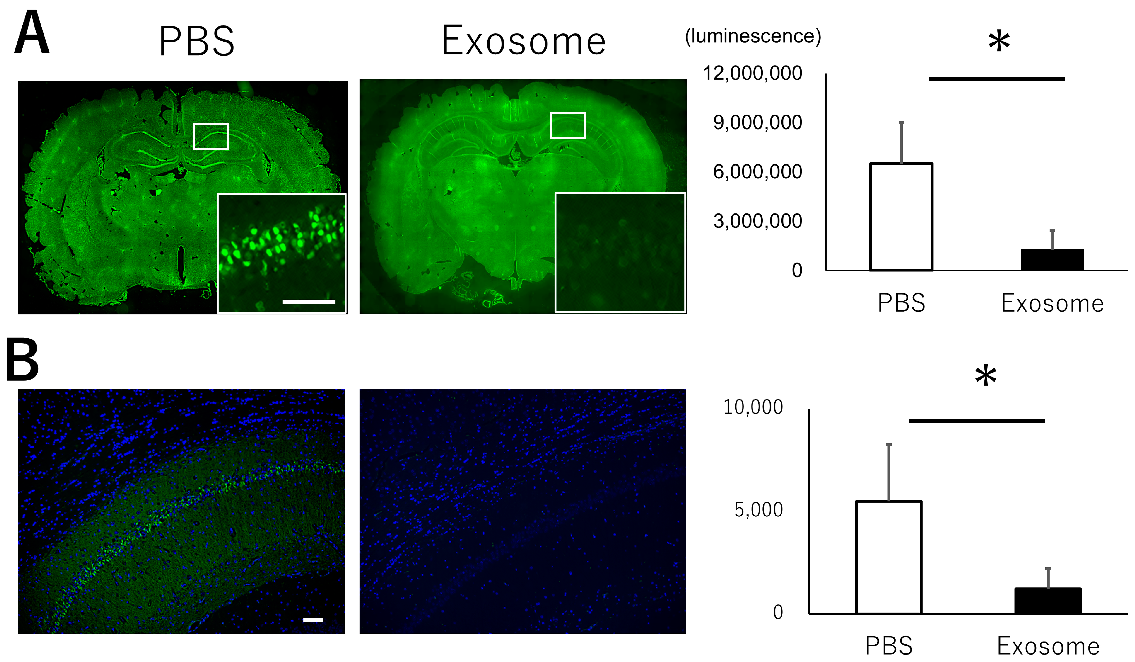 Intranasal Administration of Mesenchymal Stem Cell-Derived Exosome ...