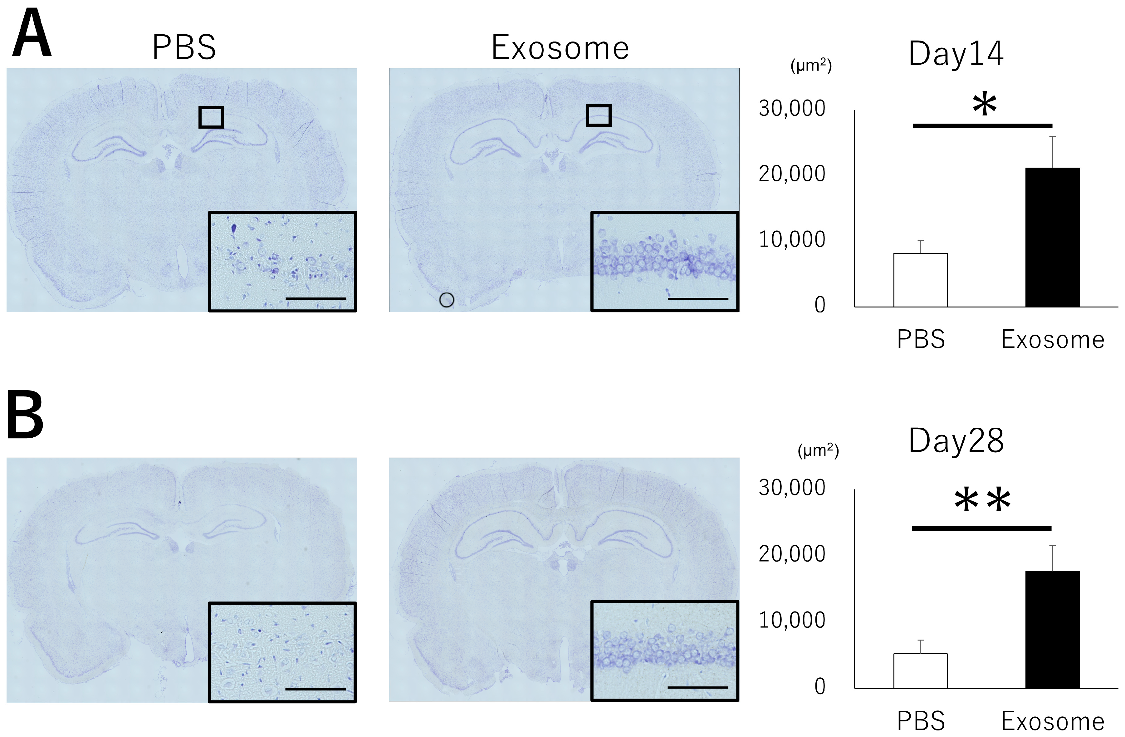 Intranasal Administration of Mesenchymal Stem Cell-Derived Exosome ...