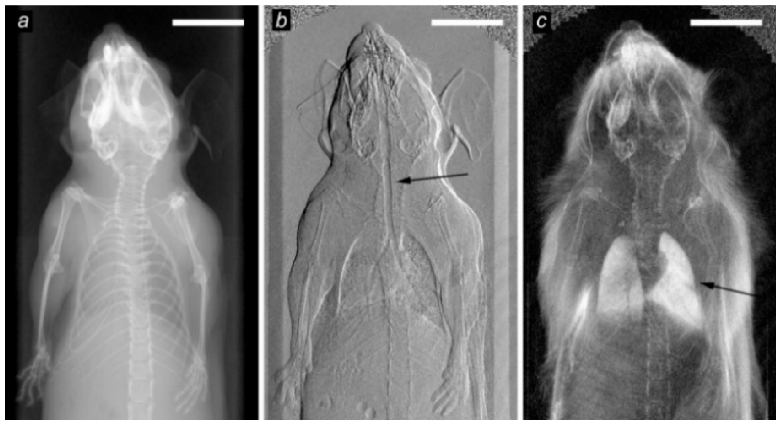 Research Progress of Grating-Based X-Ray Phase-Contrast Imaging and Key ...