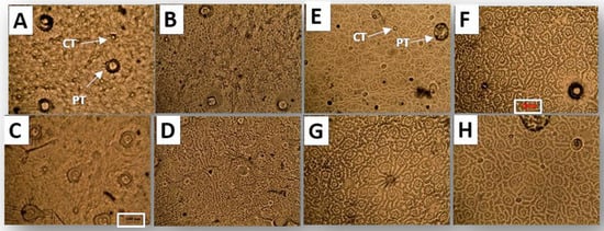 Enhanced Biochemical and Structural Defense in PGPR-Inoculated Sweet ...