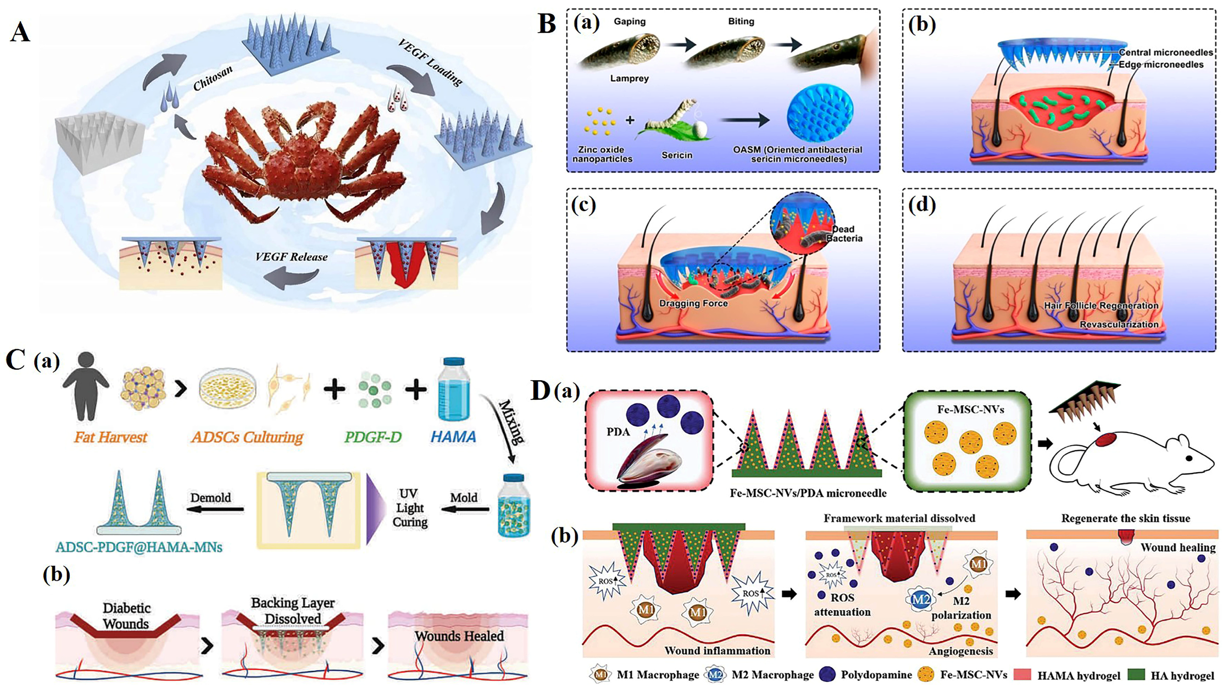 The Progress in the Application of Dissolving Microneedles in ...