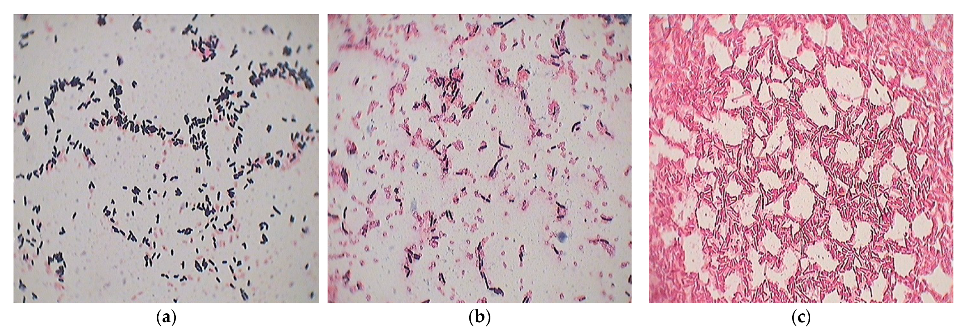 Screening of Azotobacter, Bacillus and Pseudomonas Species as Plant ...
