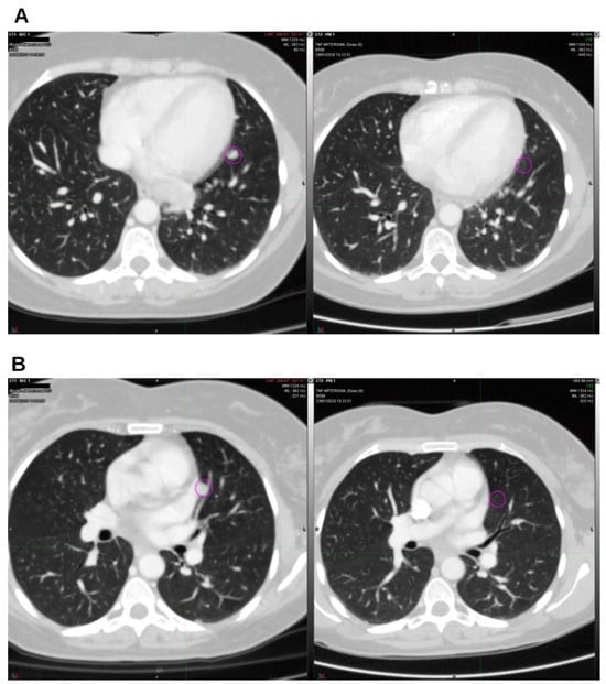 Integrative Use of Cannabidiol, Melatonin, and Oxygen–Ozone Therapy in ...