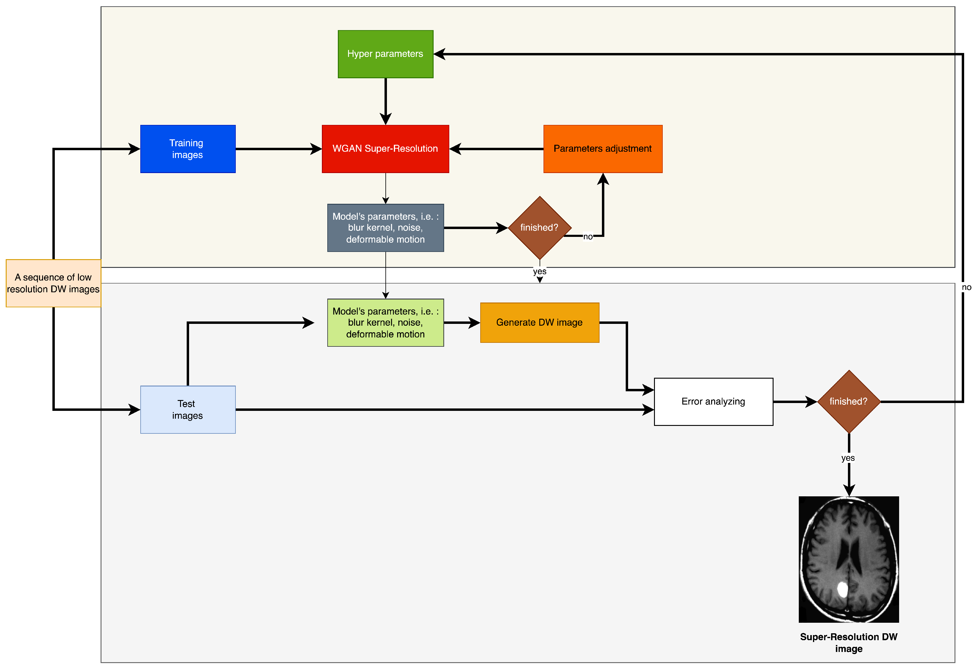 Diffusion Weighted Imaging Super-Resolution Algorithm for Highly Sparse Raw Data Sequences | MDPI