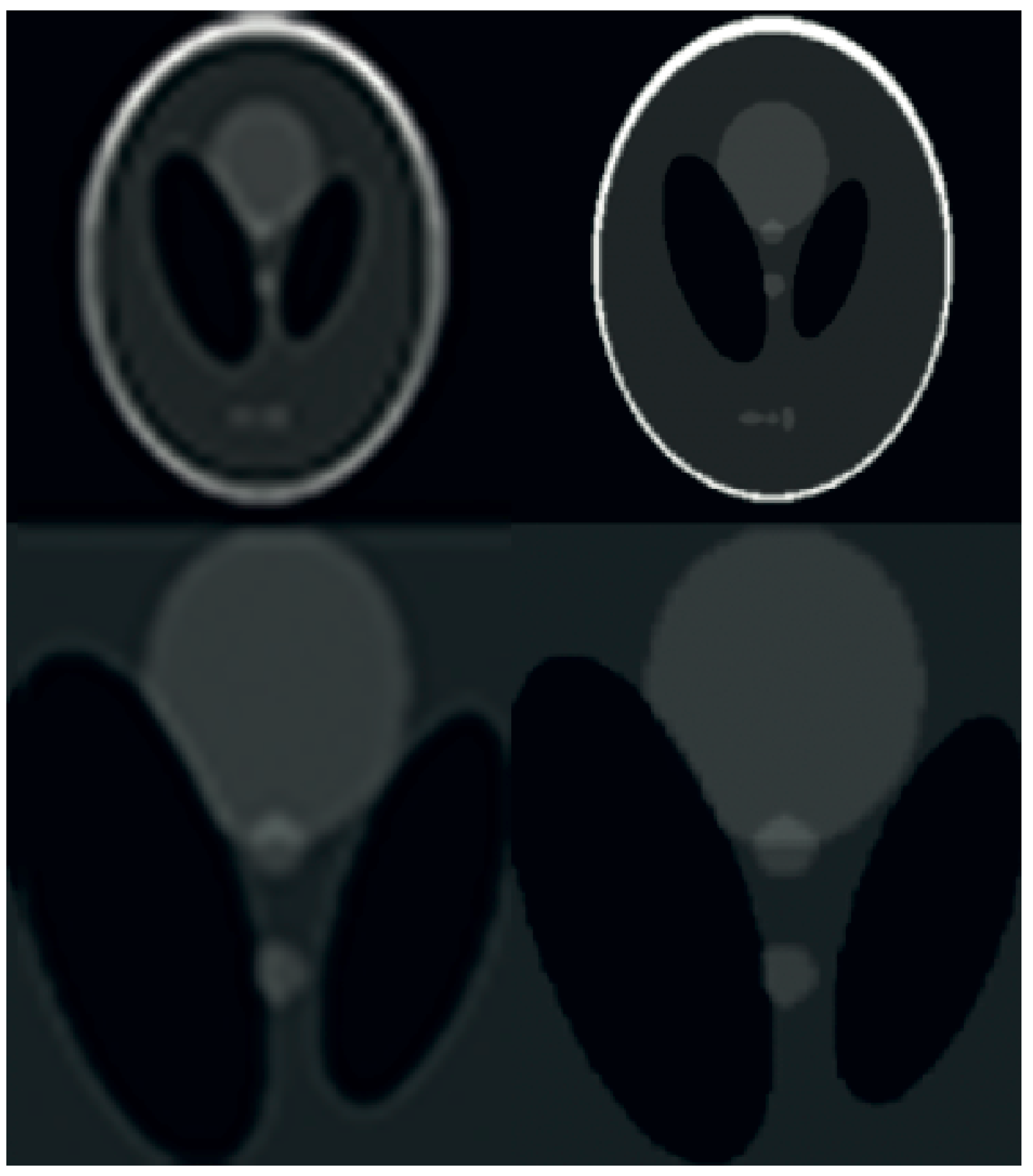 Diffusion Weighted Imaging Super-Resolution Algorithm for Highly Sparse ...