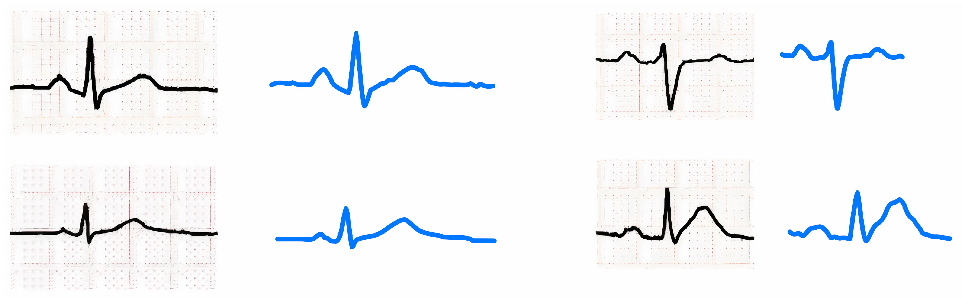 Cardiac Arrhythmia Classification Using Advanced Deep Learning Techniques on Digitized ECG ...