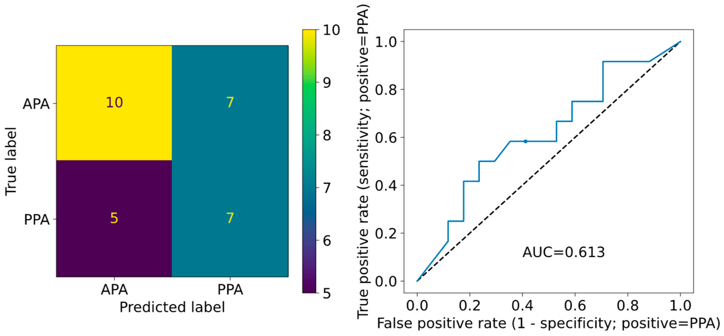 Exploring the Potential of a Smart Ring to Predict Postoperative Pain ...