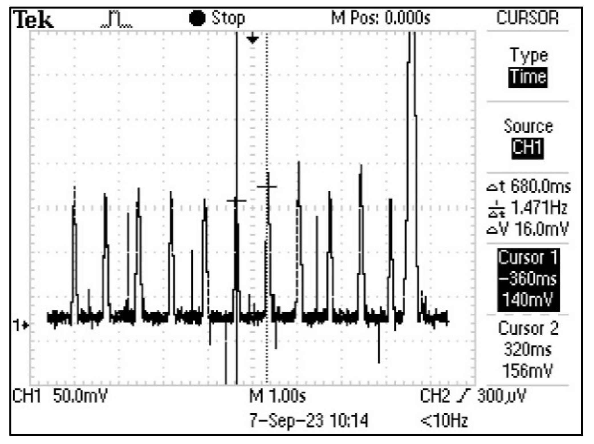 Investigating the Design of a Photoplethysmography Device for Vital ...