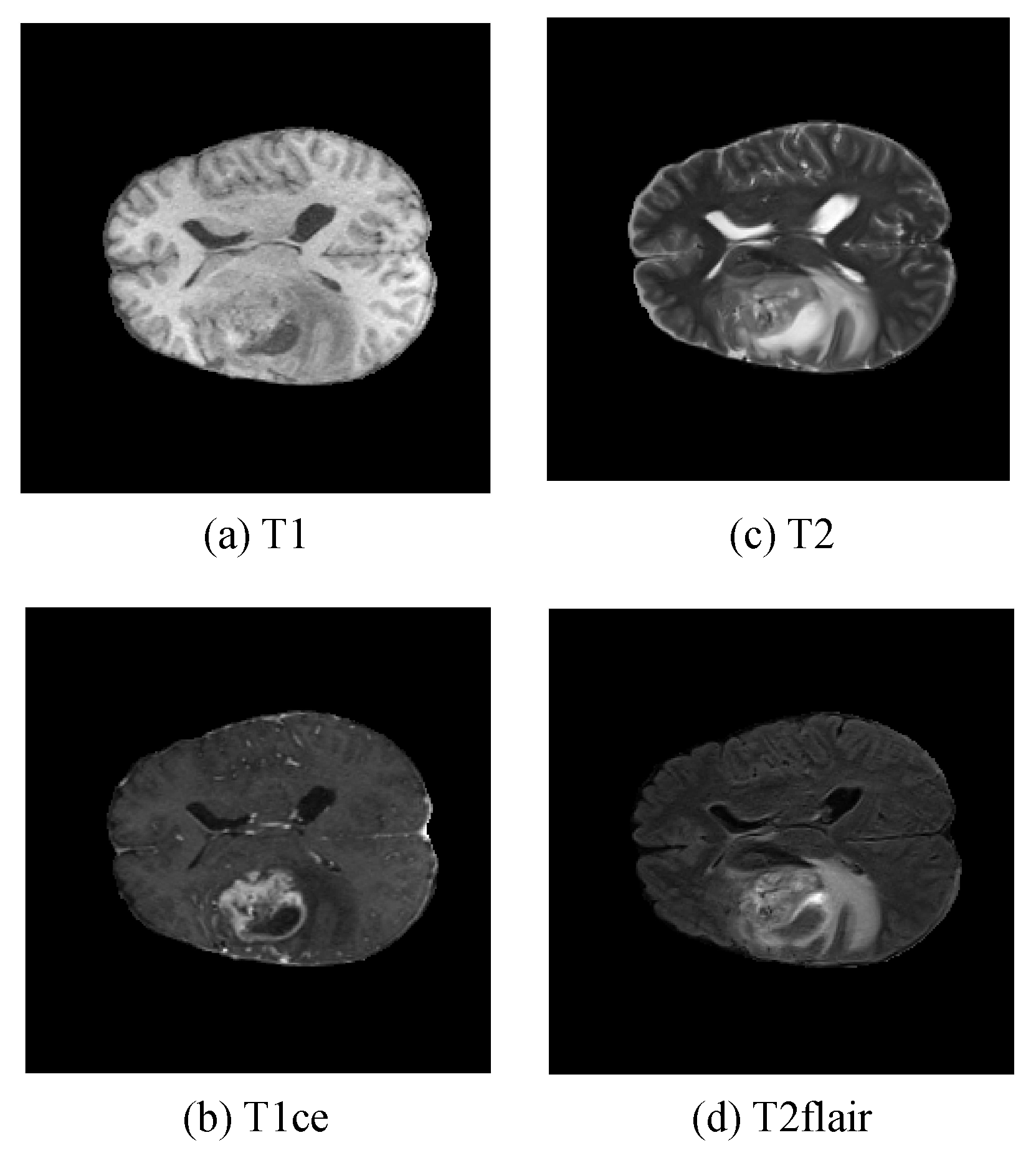 Leveraging Prior Knowledge in a Hybrid Network for Multimodal Brain ...