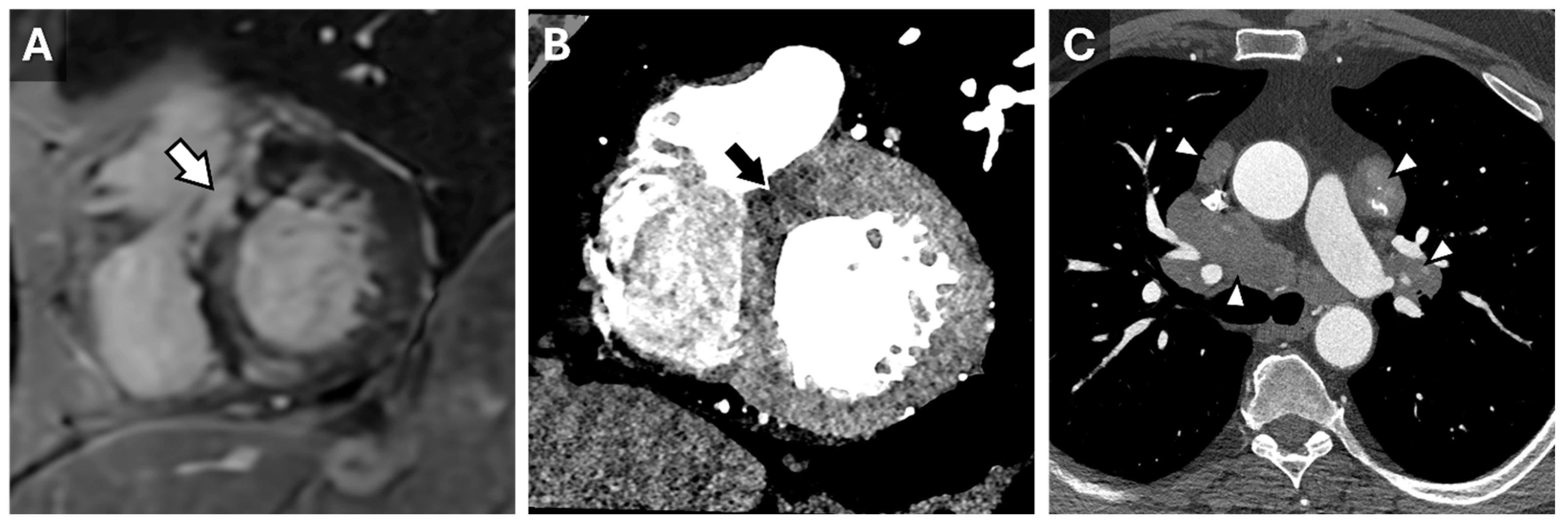 Utility of Cardiac CT for Cardiomyopathy Phenotyping | MDPI