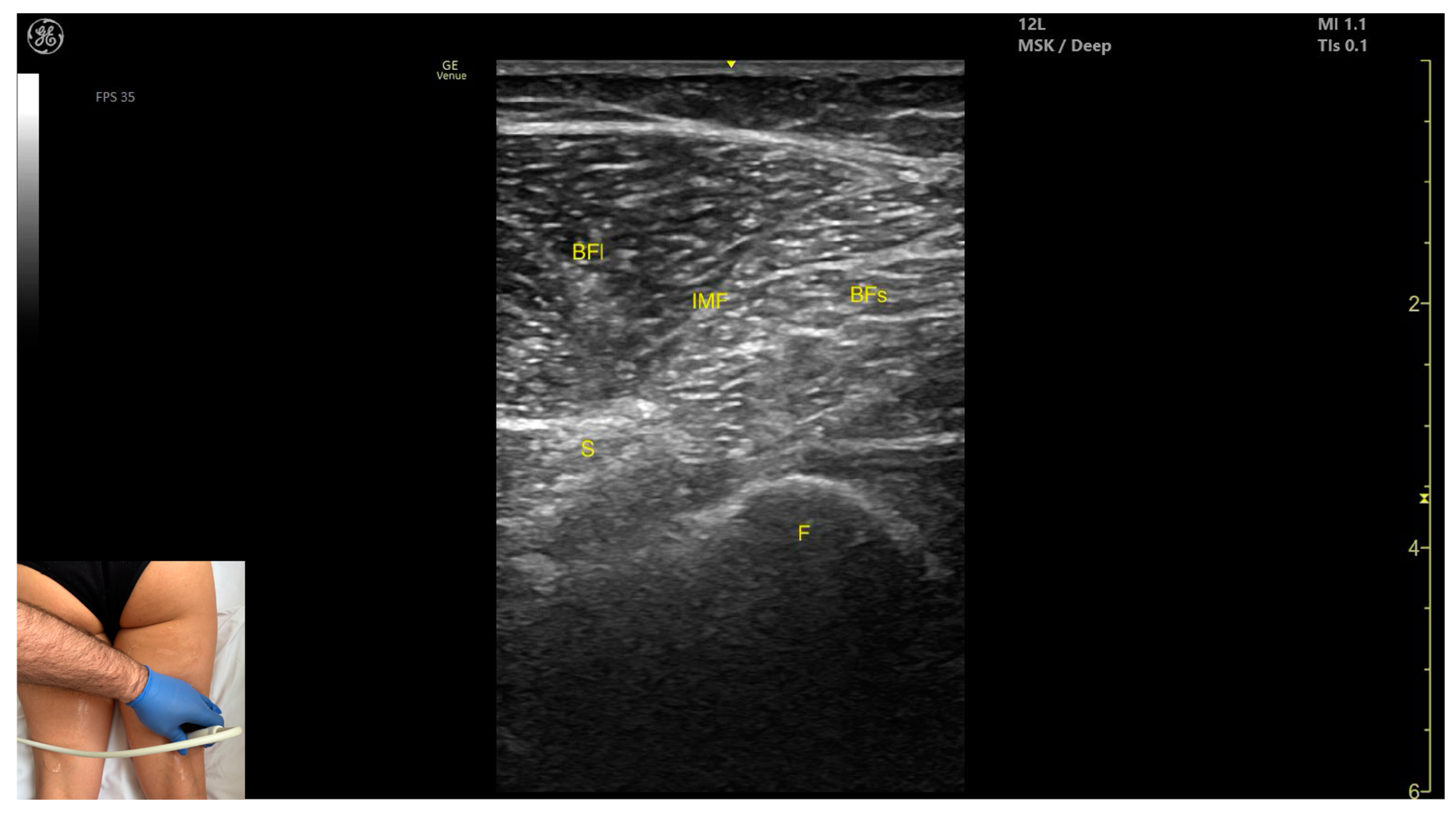 The Elias University Hospital Approach: A Visual Guide to Ultrasound ...