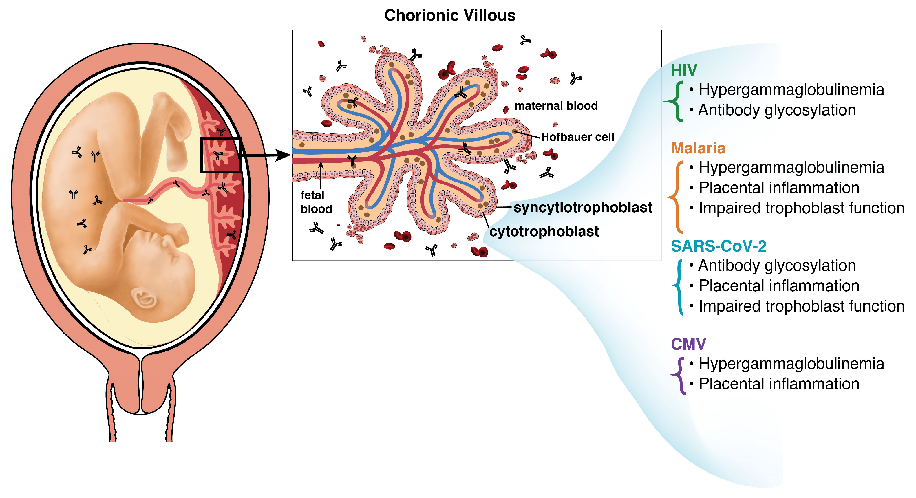 Impact of Infections During Pregnancy on Transplacental Antibody ...