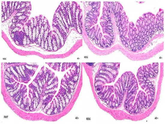 Study of Fecal Microbiota Transplantation Ameliorates Colon Morphology ...